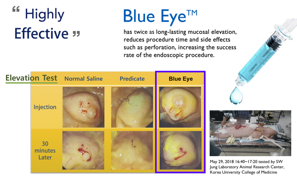 Blue Eye Submucosal Injection Agent | Blue Eye