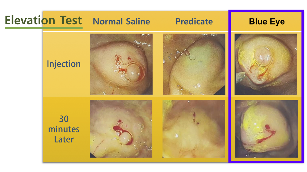 Blue Eye Submucosal Injection Agent | Blue Eye Submucosal Injection Agent